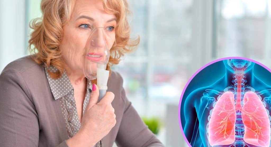 CONSECUENCIAS DE LA CONTAMINACIÓN DEL AIRE, causas y más